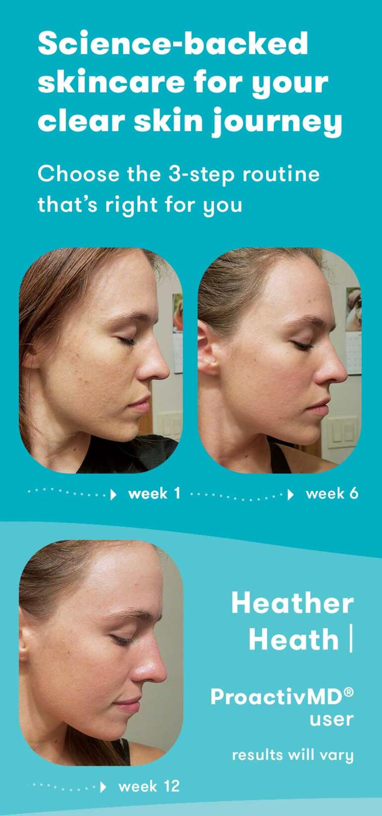 For All Skin Types | Acne & Skincare Treatment | Proactiv®